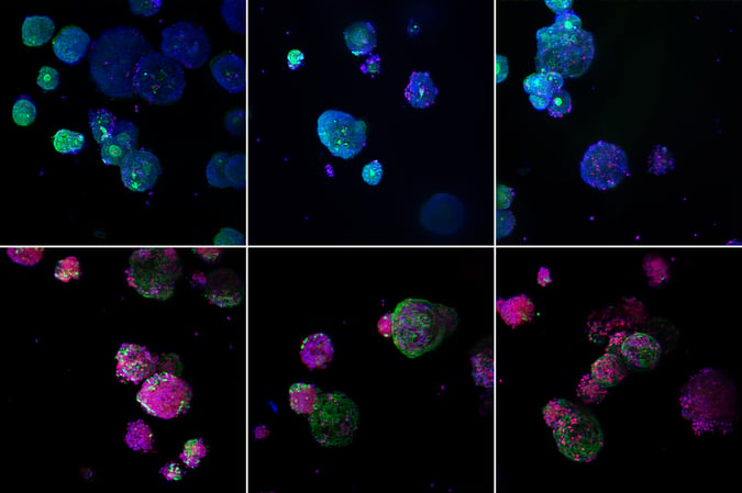 Custom Organoid Expansion Service. Get reproducible, assay-ready PDOs.