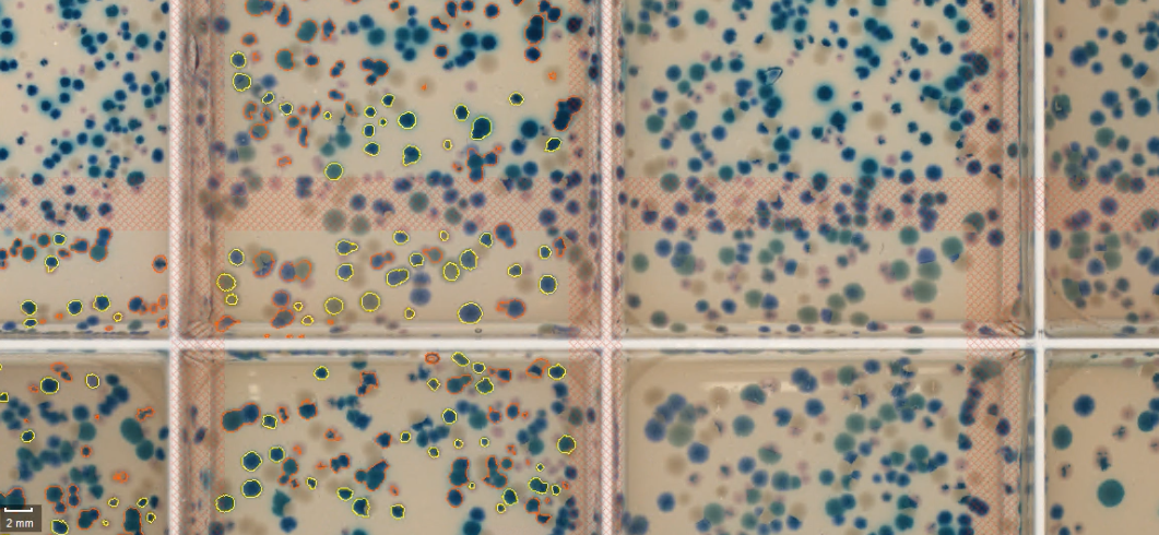 Introducing the all-new QPix FLEX Microbial Colony Picking System